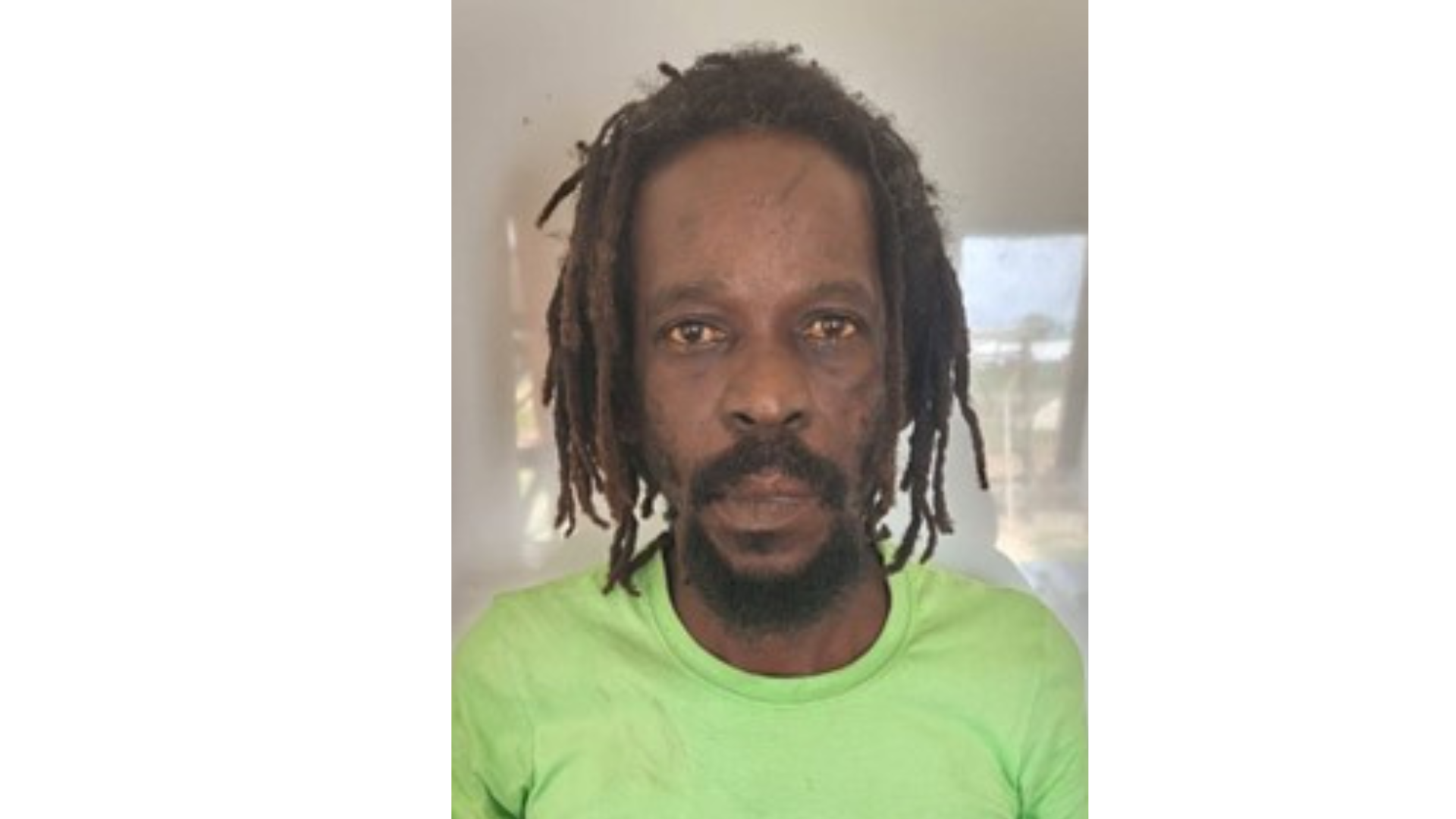 ‘Monkey’ on remanded for attempted murder - HGPTV - Guyana's Nightly ...