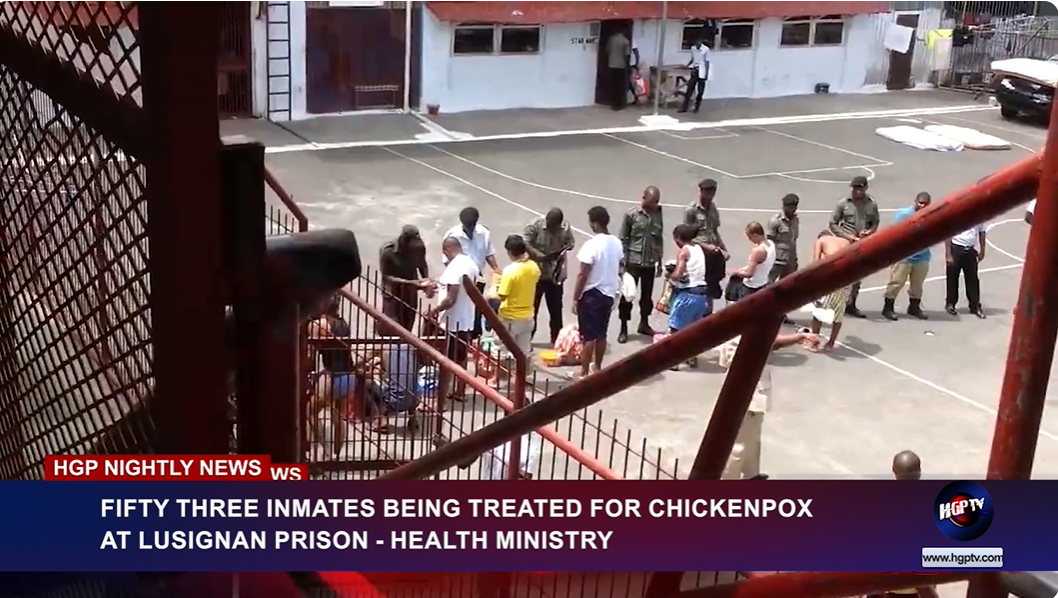FIFTY-THREE INMATES BEING TREATED FOR CHICKENPOX AT LUSIGNAN PRISON ...
